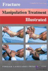 Fracture Manipulation Treatment IllustratedISBN: 7119020447